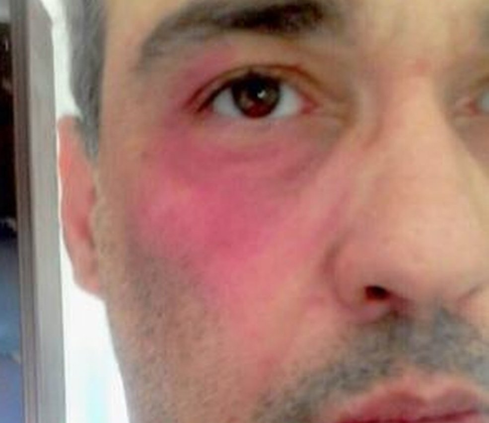 Paciente agride com socos no rosto médico que não quis dar atestado