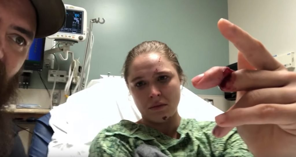 Ronda Rousey mostra como ficou dedo decepado após acidente em gravação ...