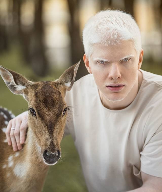 Conheça Bera, o artista que doou R$ 4,5 milhões para a Amazônia ...