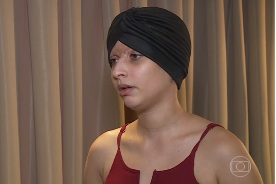 Jovem escalpelada em kart: “Fiquei abismada em ter que pôr preço ...