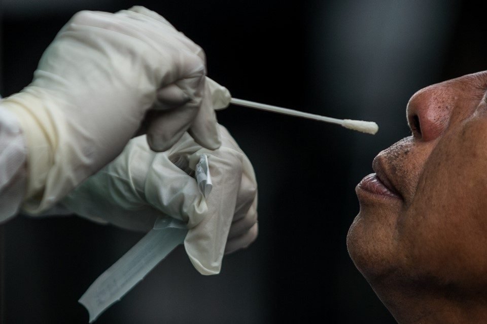 Coronavírus: EUA aprovam 1º teste para ser feito em casa