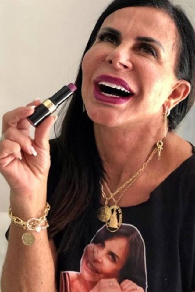 Gretchen conta detalhes da nova plástica: “Tirei um pedaço do lábio ...