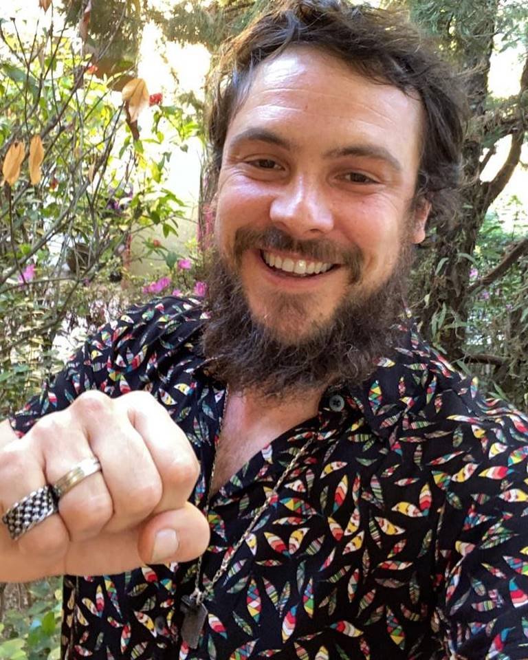 Sergio Guizé ostenta novo visual após transplante capilar | Metrópoles