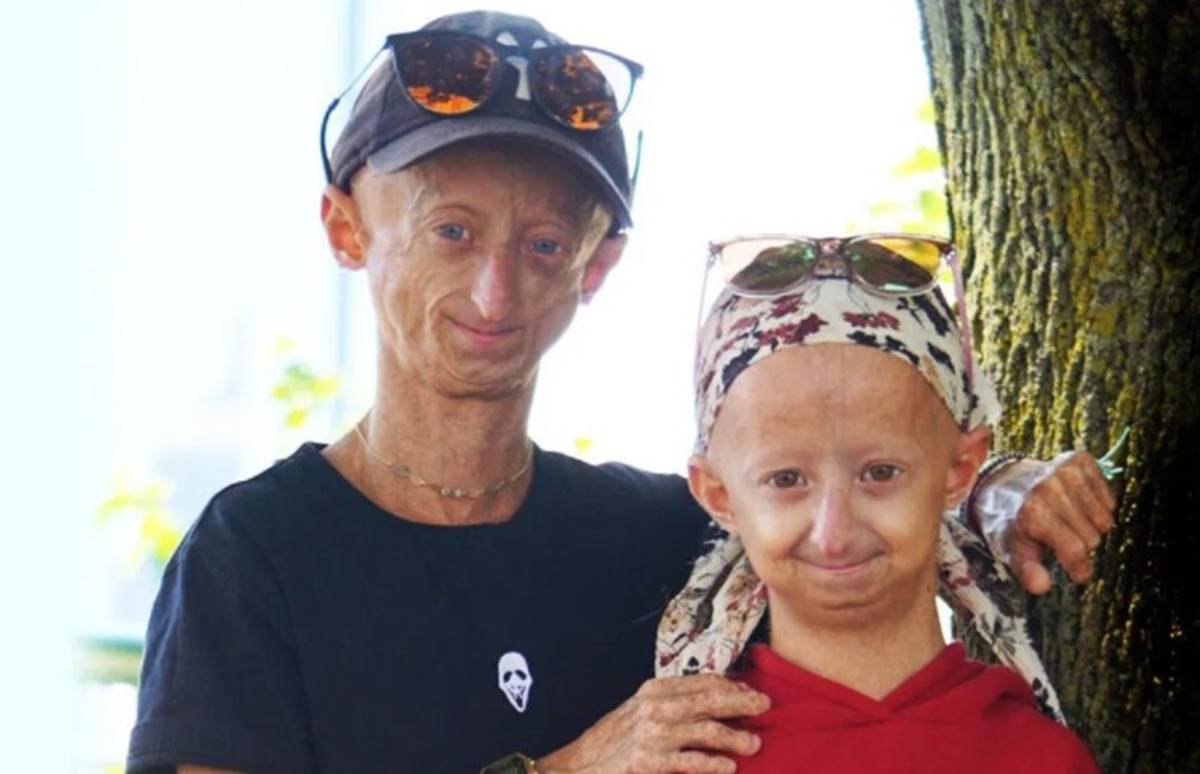 EUA aprova primeiro medicamento para tratar a doença progeria | Metrópoles