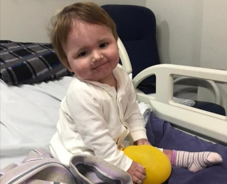 Bebê com 72% do corpo queimado após reação alérgica recebe alta ...