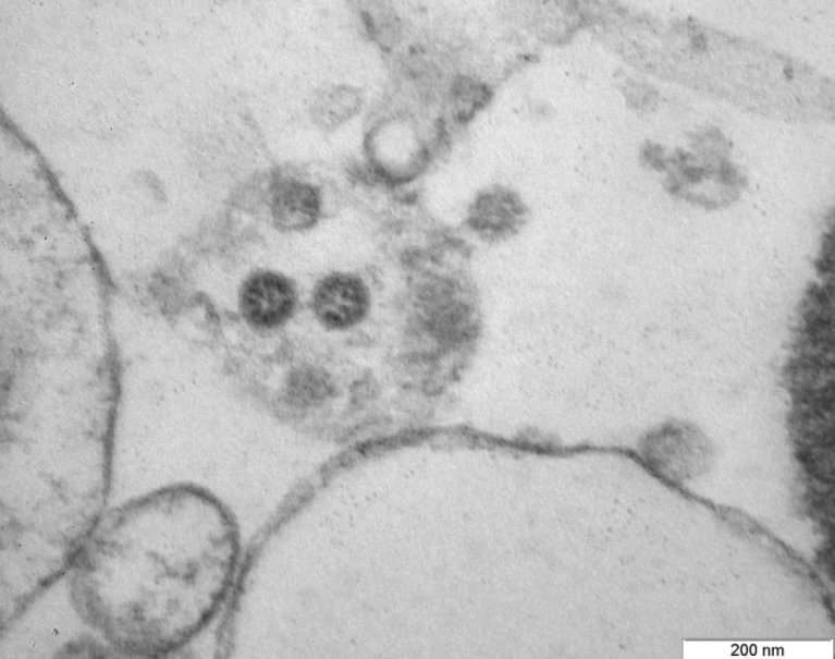 Veja as primeiras imagens em alta resolução da variante Ômicron ...