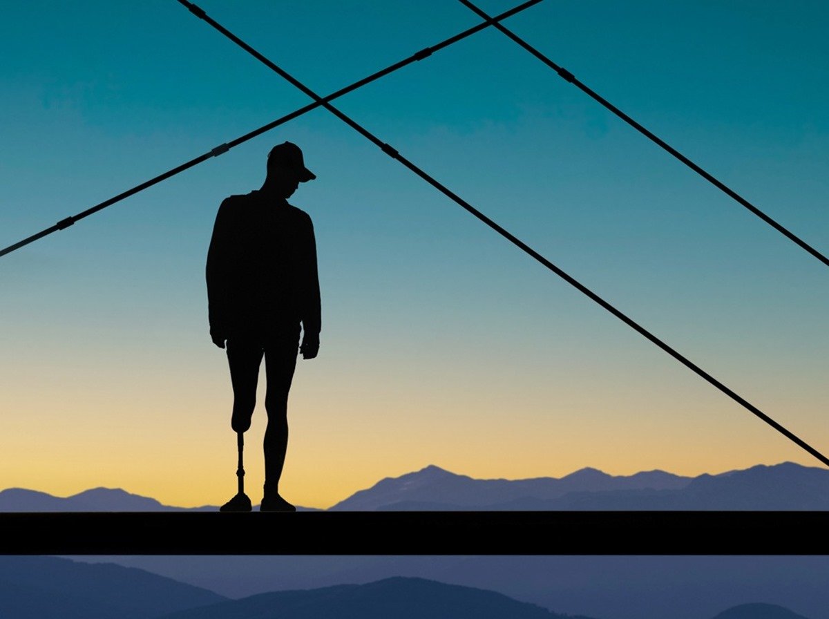 Amputações são mais comuns do que se imagina. Confira principal causa