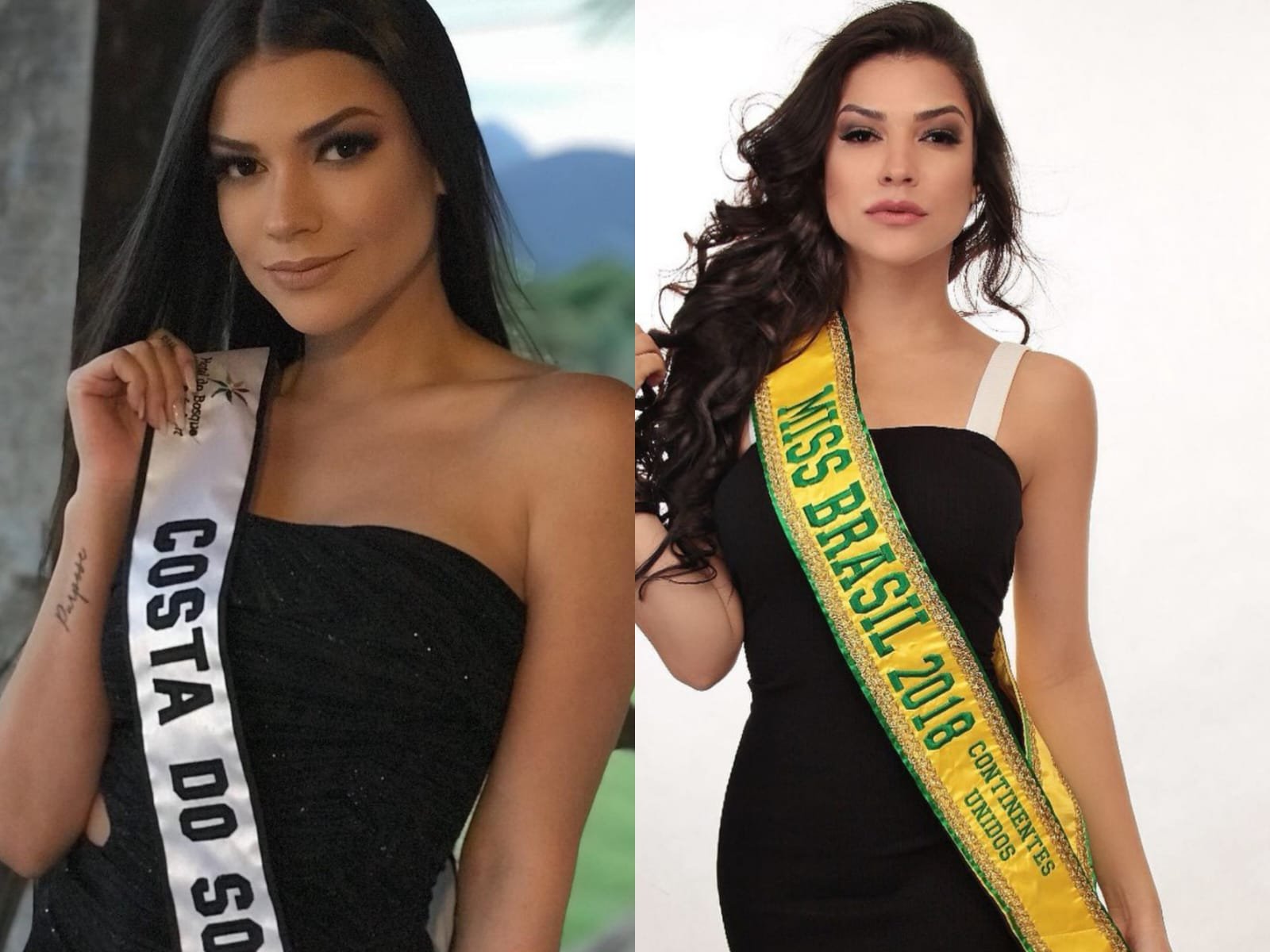 Ex-miss de 27 anos morre após complicação em cirurgia de amigdalite ...