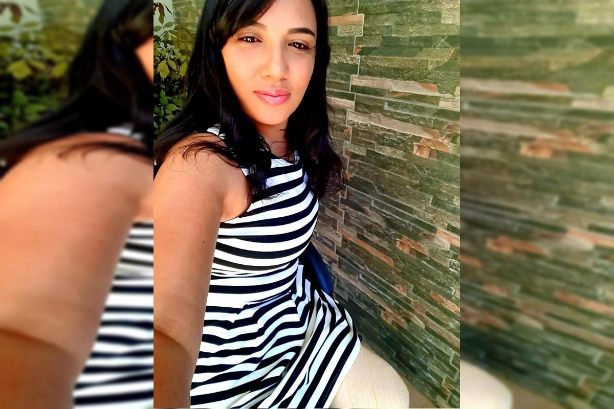 Rede Sarah sobre jovem amputada: “Temos condições de fazer próteses ...