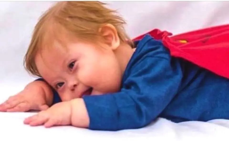 Morre Super Chico, menino com Down que superou a Covid por duas vezes ... Morre Super Chico, menino com Down que superou a Covid por duas vezes ...