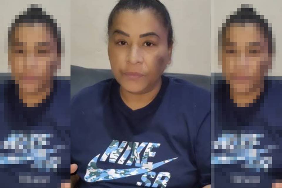 MC Kátia terá de amputar parte do pé após retirada de mioma | Metrópoles