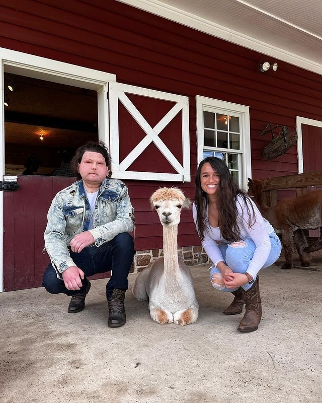 Primeiro homem que teve mãos e rosto transplantados encontra namorada ...