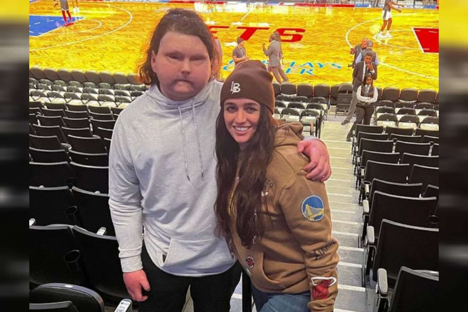 Primeiro homem que teve mãos e rosto transplantados encontra namorada ...