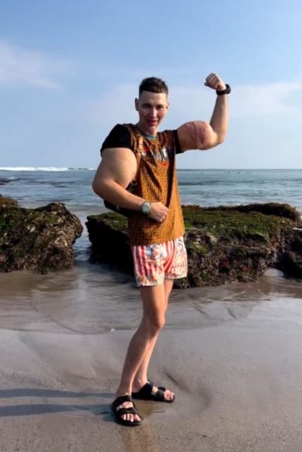 “Popeye russo” procura novo amor “sem celulite e sem cheiro de caspa ...