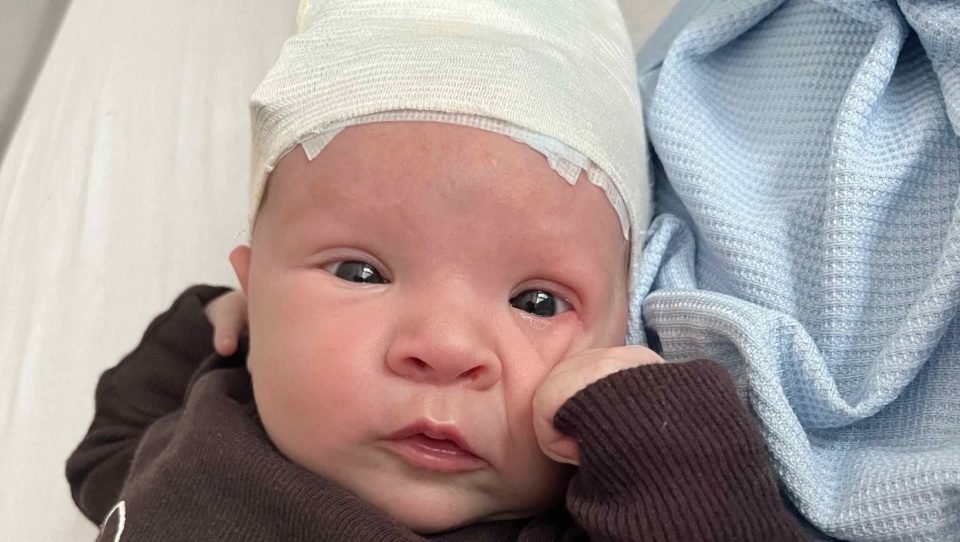 Bebê Que Só Roncava Quando Acordada é Diagnosticada Com Malformação
