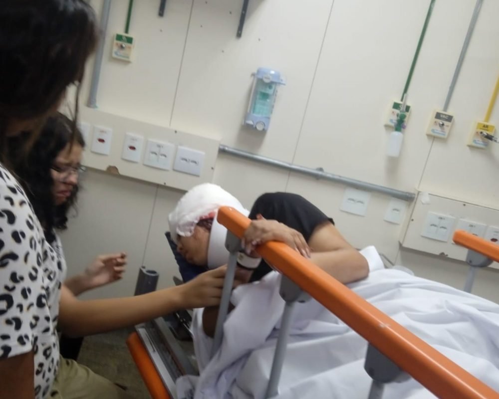 Jovem escalpelada em kart pede ajuda para colocar prótese capilar ...