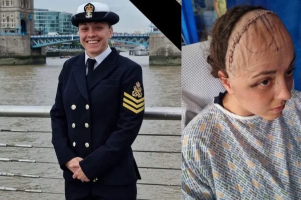 Mulher que sentia sede e cansaço constantes descobre câncer no cérebro ...